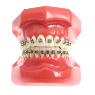 Modelos de Bracket Tipondonto de Estudio SlimDent